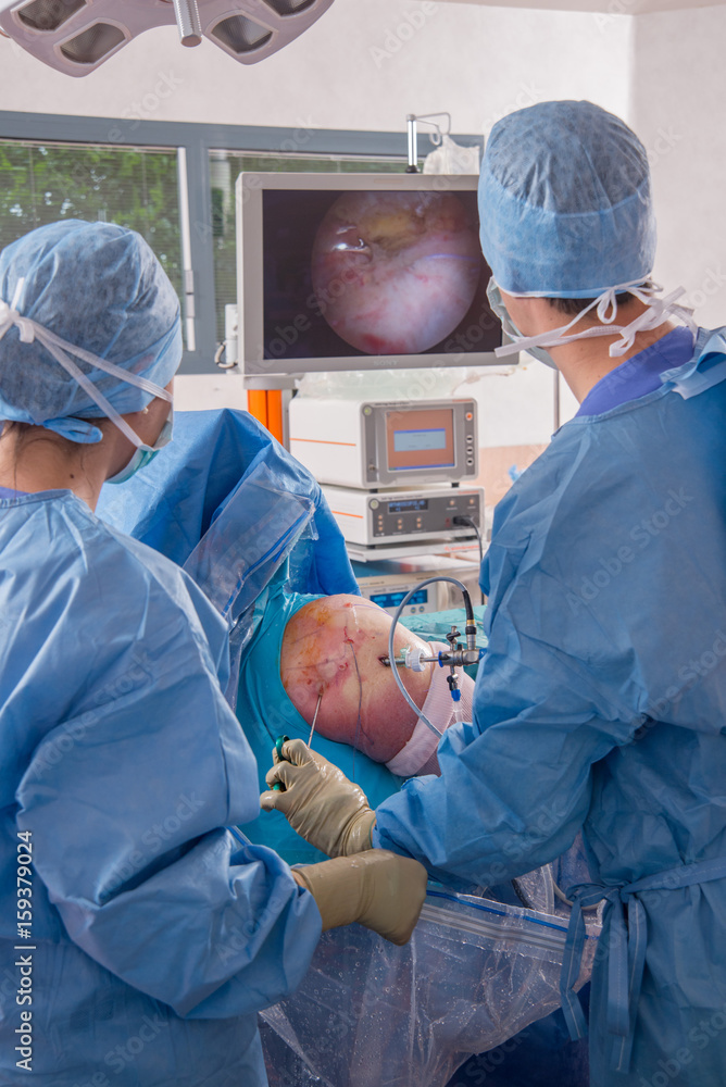 SHOULDER, ARTHROSCOPY Stock Photo | Adobe Stock