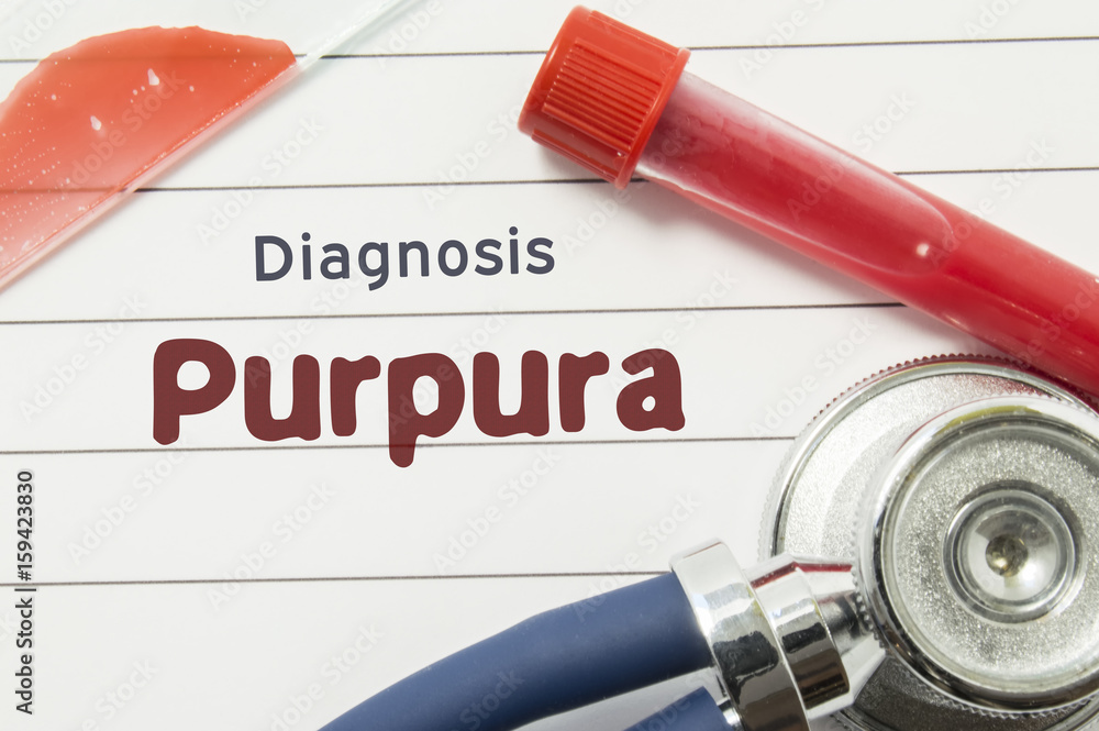 Diagnosis of Purpura. Medical book with text header hematological ...