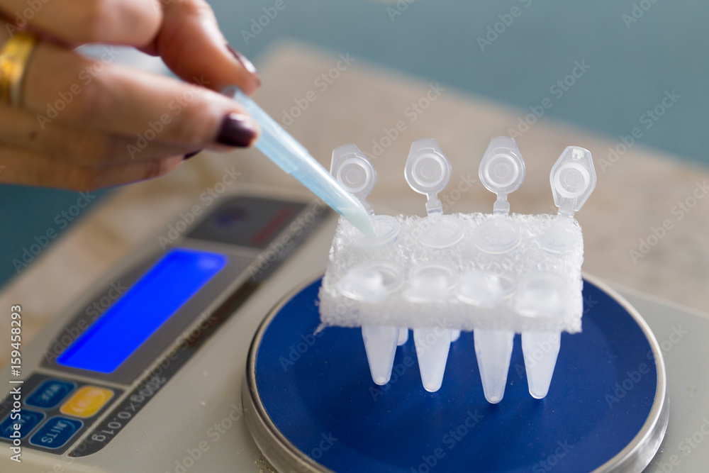 Equipment for analyze samples into the agarose gel and for the ...