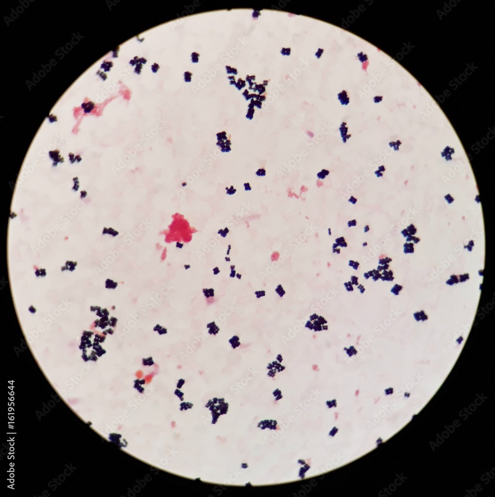 Cocci Bacteria Under Microscope