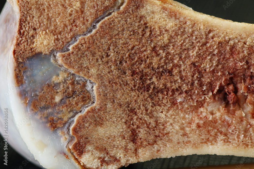 Pig leg bone show the cross section part.. Stock Photo | Adobe Stock