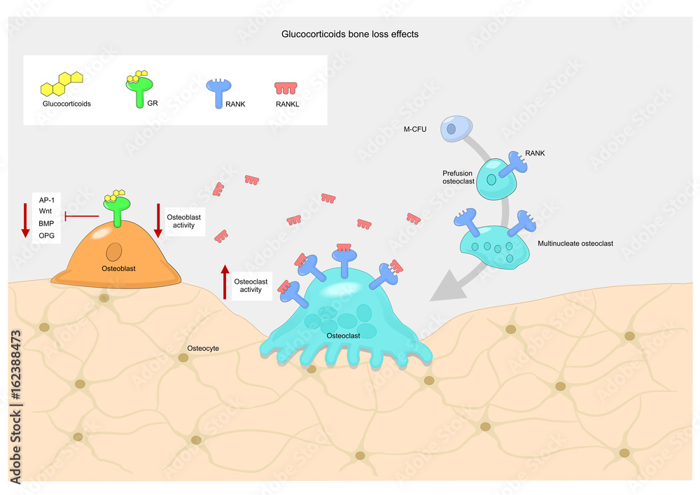 Glucocorticoids and it side effects on bone metabolism. Stock Vector ...