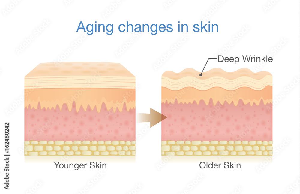 Aging Changes in Skin. Illustration about medical diagram and health ...
