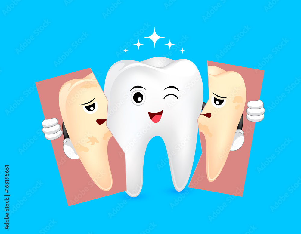 Cute cartoon whitening tooth holding tear of unhealthy tooth. Dental ...