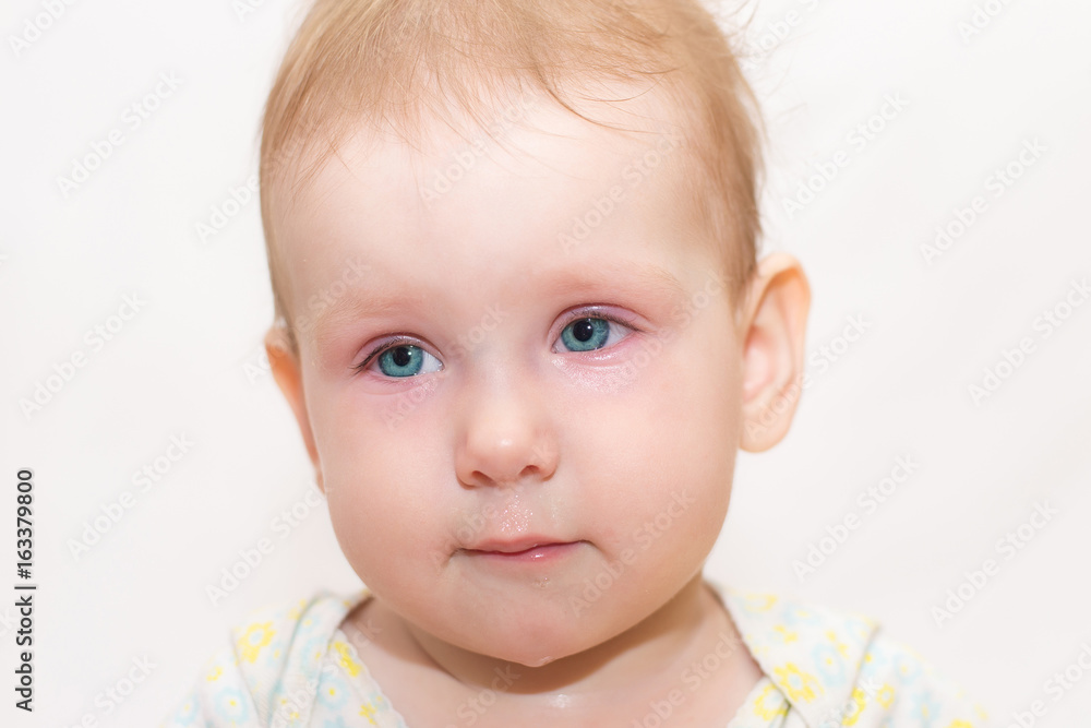 Little cute little girl with red eyes and a tear on her cheek on a ...