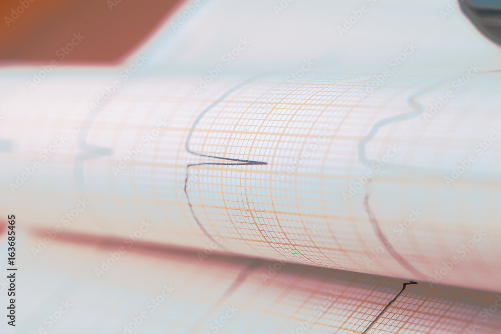 ECG chart on the table Stock Photo | Adobe Stock