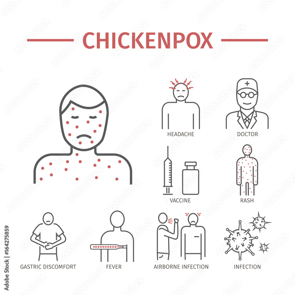 Chickenpox. Symptoms, Treatment. Line icons set. Vector signs Stock ...