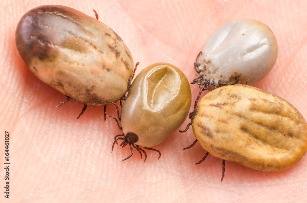Tick filled with blood sitting on human skin Stock Photo | Adobe Stock