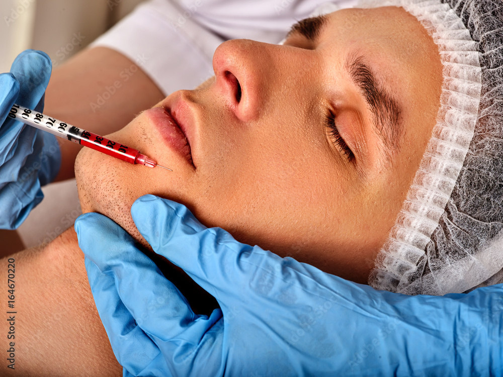 Foto Stock Filler injection for male forehead face. Plastic aesthetic ...