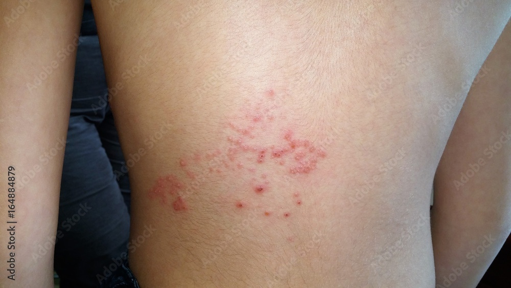 Zona Stock Photo | Adobe Stock