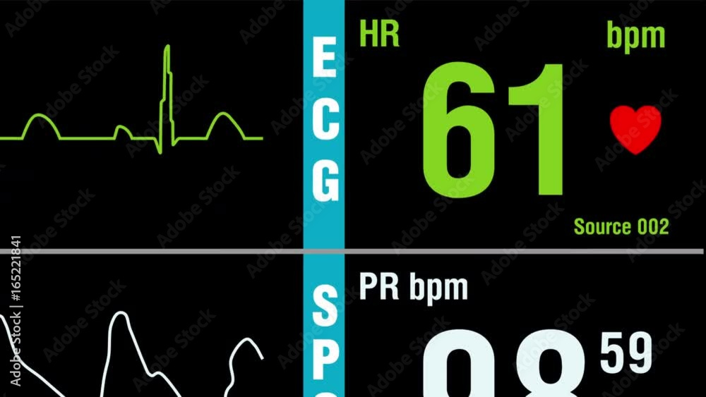 Patient display with vital signs ECG electrocardiogram, oxygen ...