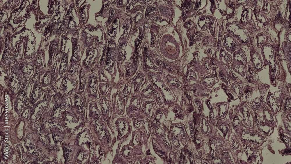human scrotum cells under a microscope zoom in animation vídeo de Stock ...