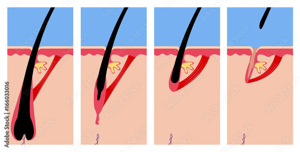 life cycle of hair fall vector Stock Vector | Adobe Stock