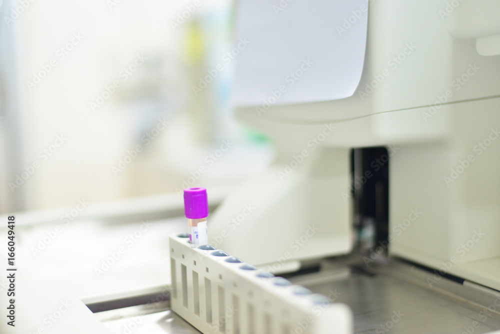 Specimen Collection Of Pleural Fluid at Gemma Mate blog