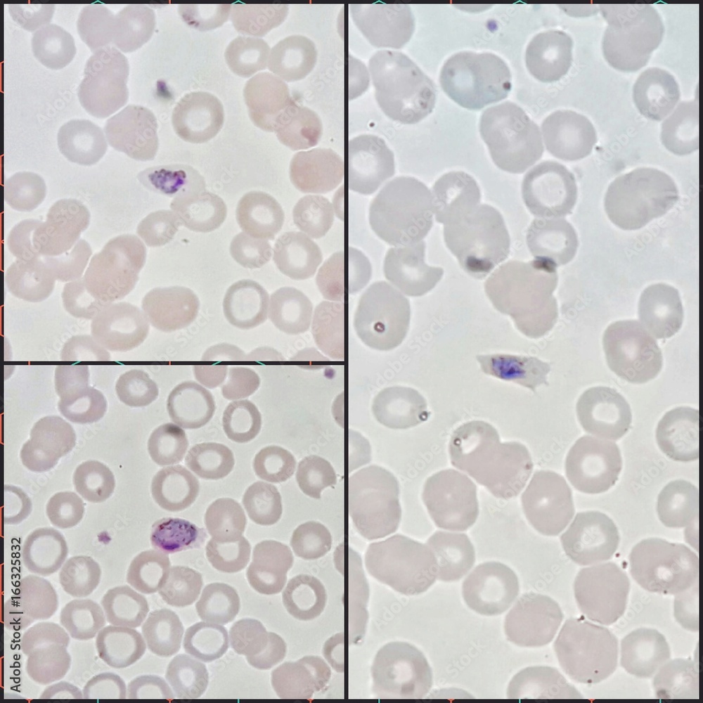 Three human parasite form patterns, trophozoite form of Plasmodium ...