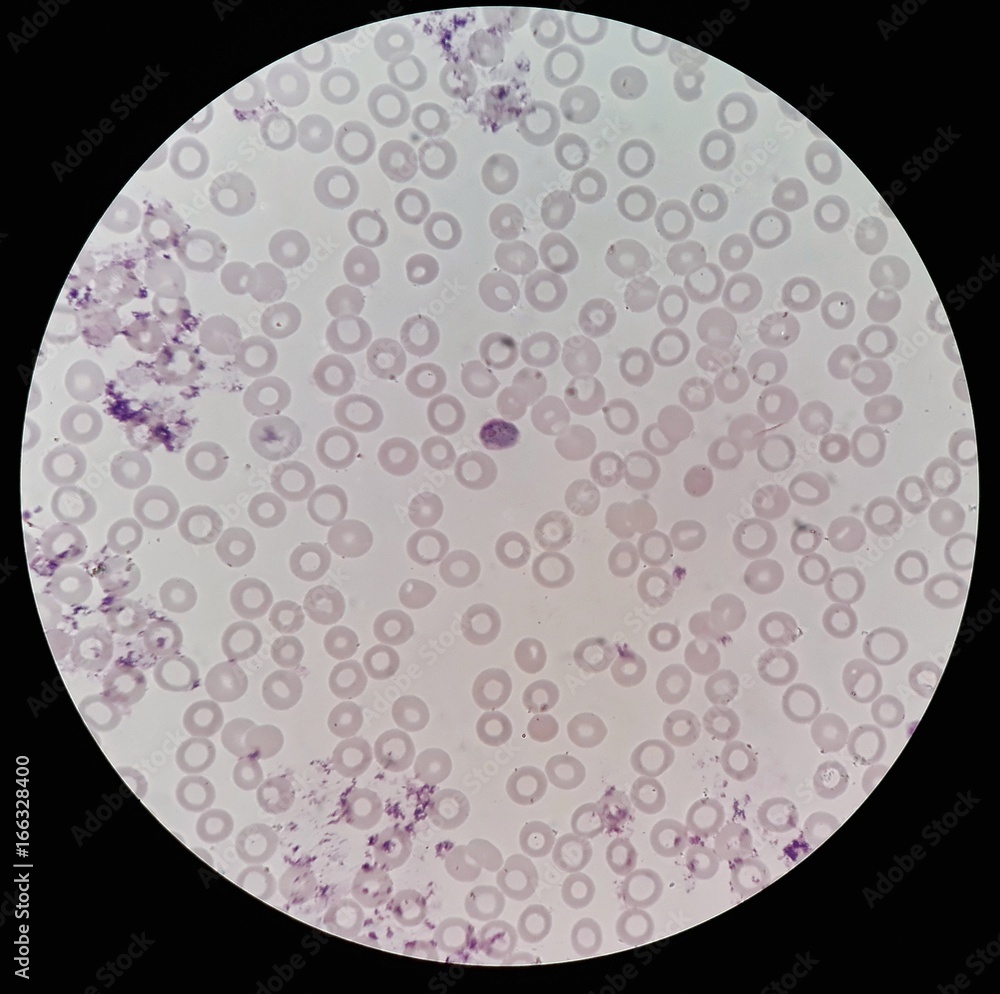 Under 100X light microscope, human parasite on thin film of blood smear ...