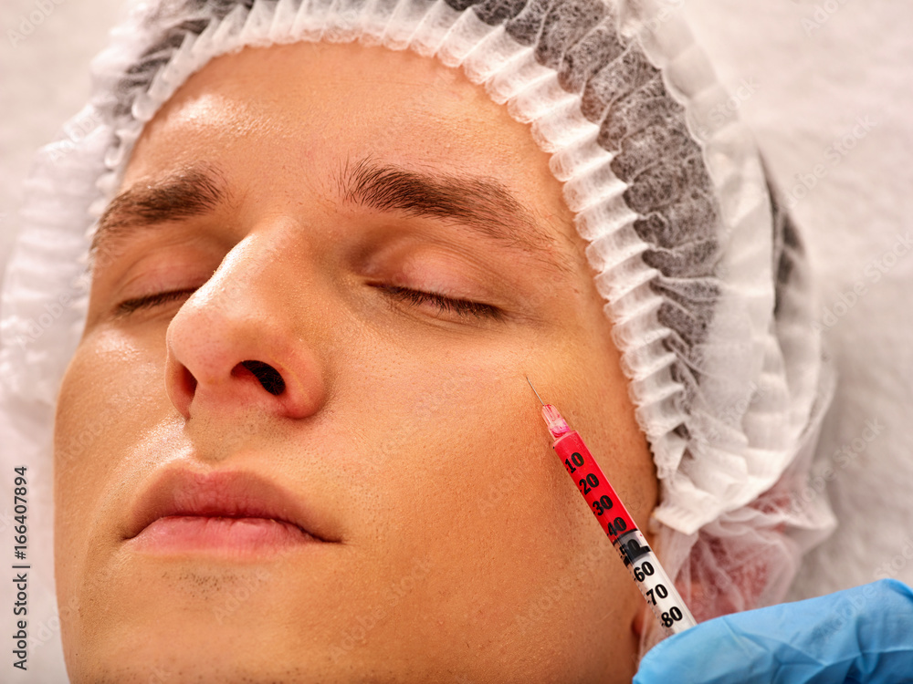 Filler injection for male forehead face. Plastic aesthetic facial ...