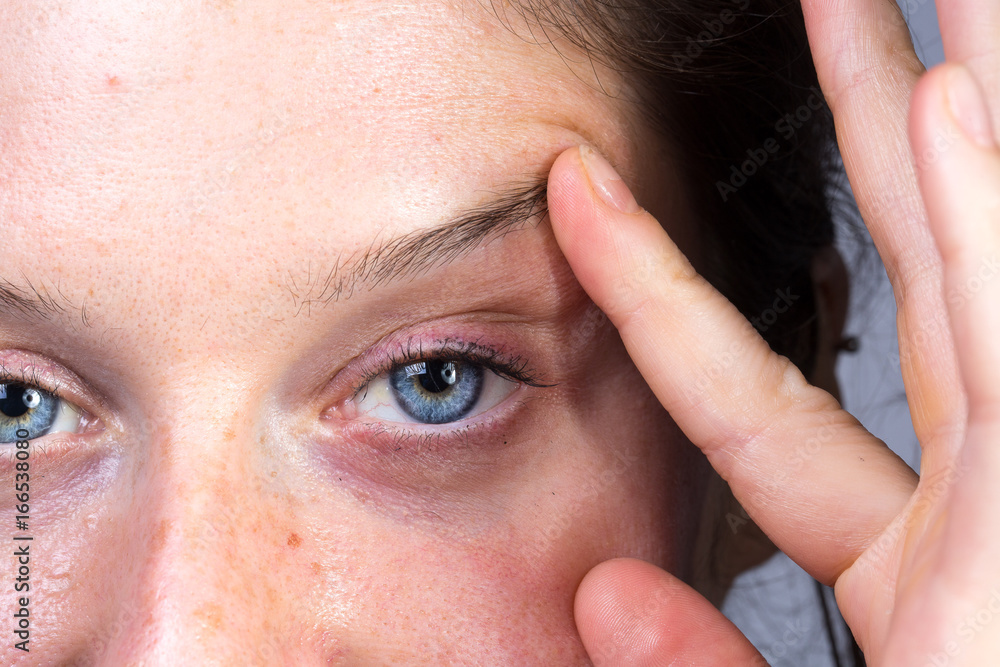 Girl lifting her eyelid with finger Stock Photo | Adobe Stock