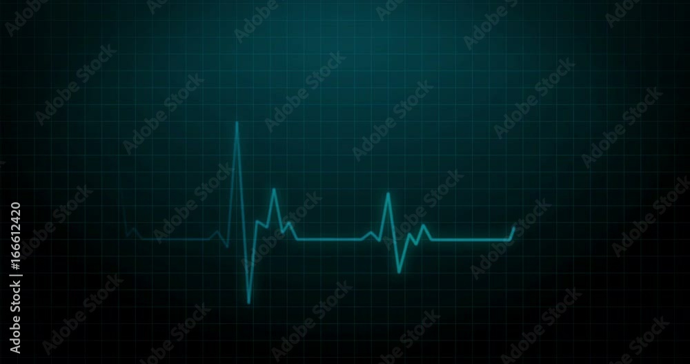 Electrocardiogram (EKG) Heartbeat Recording of Death or Coma - Blue ...