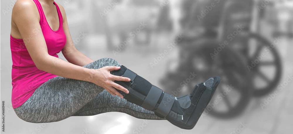 broken leg, injury woman wearing sportswear and ankle support, leg cast ...