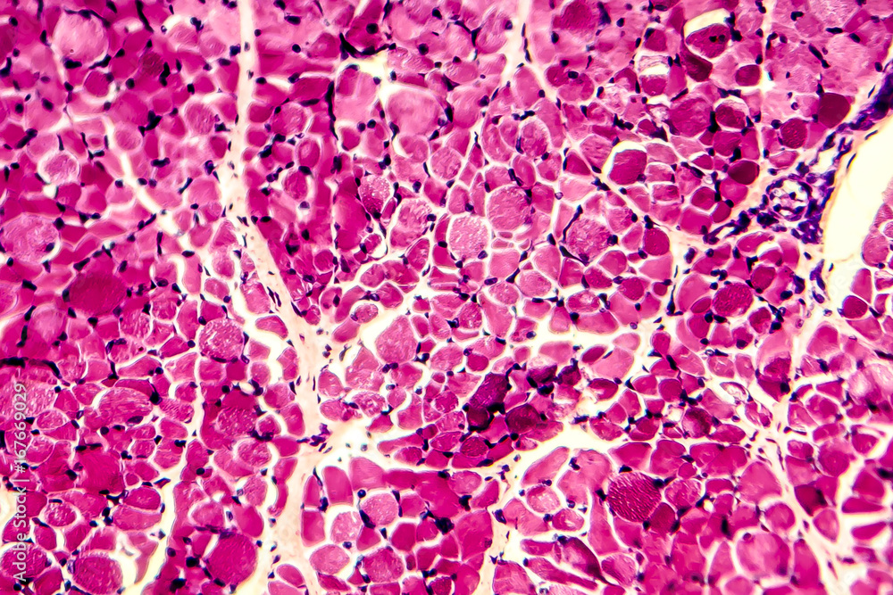 Cross-section of skeletal muscle. Photo under microscope Stock Photo ...