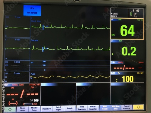 Patient monitor displays vital signs ECG electrocardiogram EKG, body ...