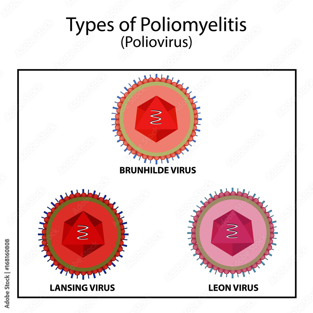 Types of poliovirus. The Brunnhild virus. Virus Lansing. The virus Leon ...