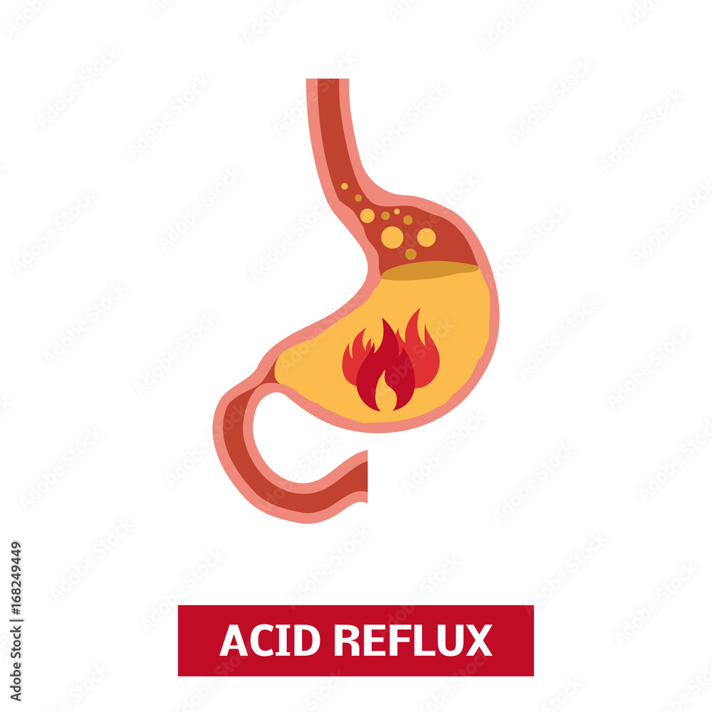 Acid reflux vector icons Stock Illustration | Adobe Stock