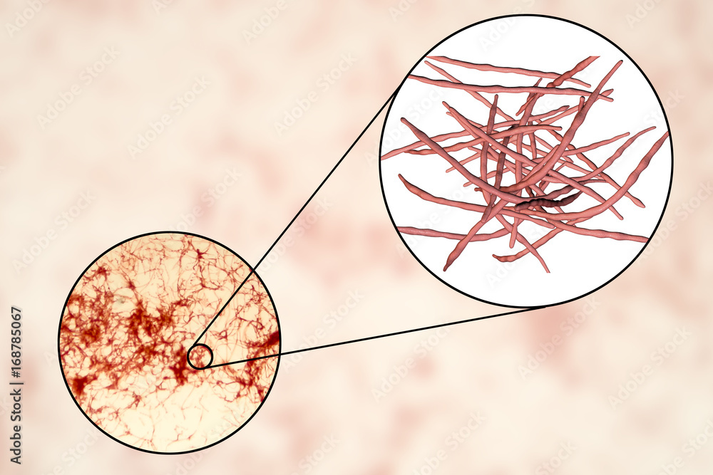 Actinomycetes Gram Positive Anaerobic Bacteria Which Resemble Fungi 3d Illustration