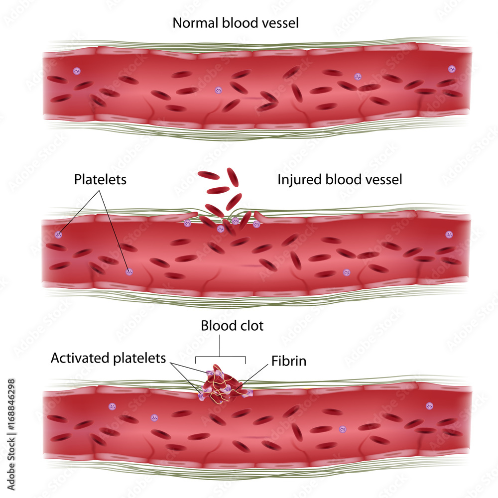 Blood Clotting Process Stock Illustration Adobe Stock Blood Clotting Process Stock Illustration Adobe Stock