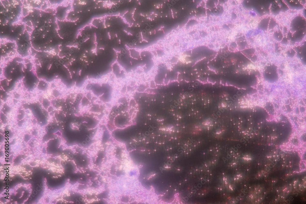 Bacillus is a genus of gram-positive, rod-shaped bacteria and a member ...