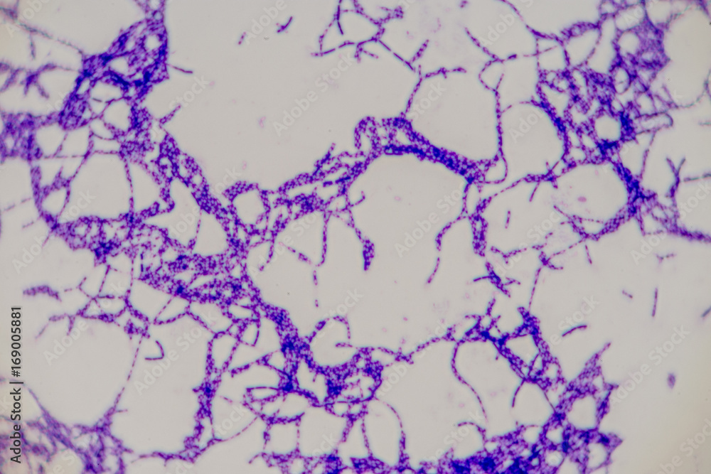 Bacillus is a genus of gram-positive, rod-shaped bacteria and a member ...