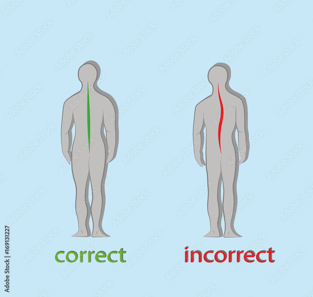 Correct alignment of human body in standing posture for good ...