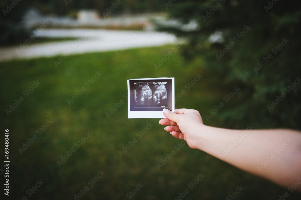 Ultrasound scan of baby in hands on green bakcground Stock Photo ...