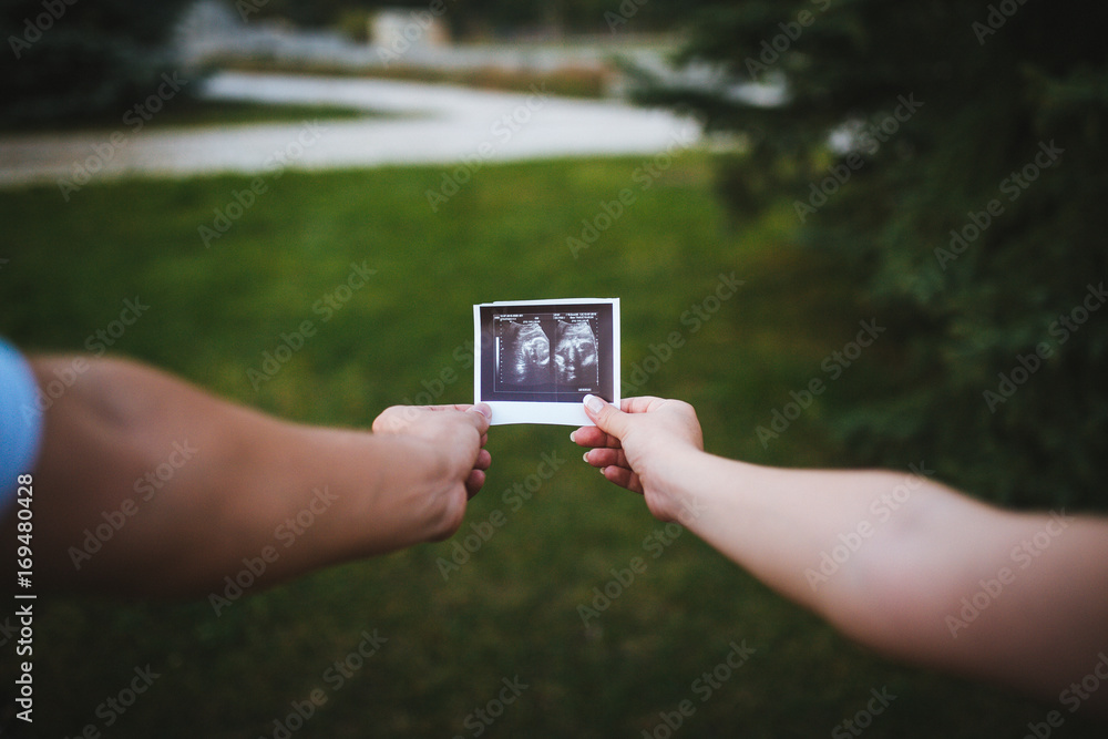 Ultrasound scan of baby in hands on green bakcground Stock Photo ...