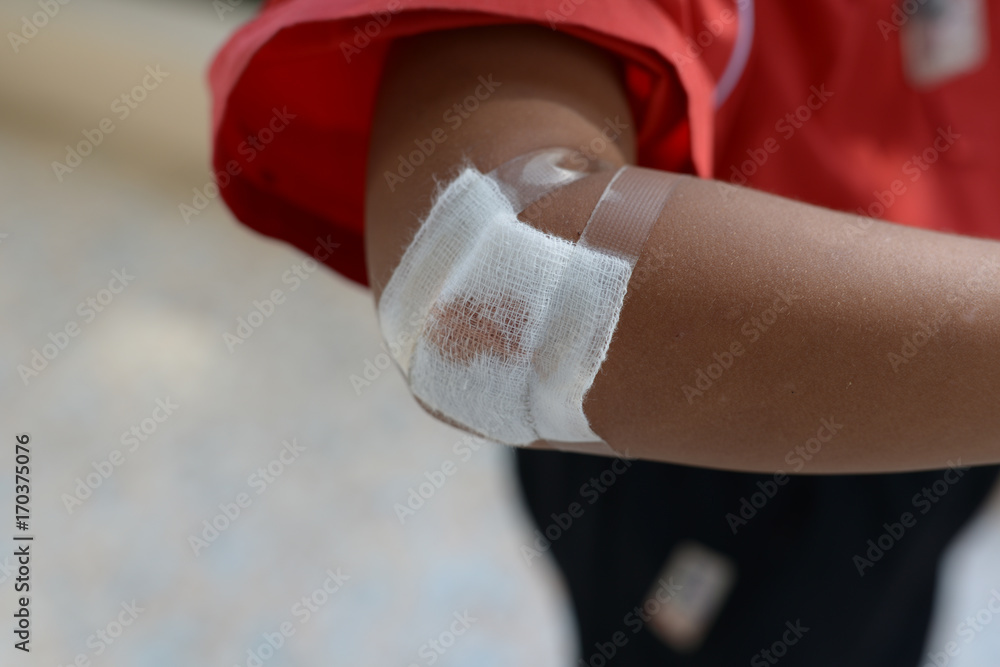 Boy injured. Bloody wound on the child's arm with bandage. bandage in ...