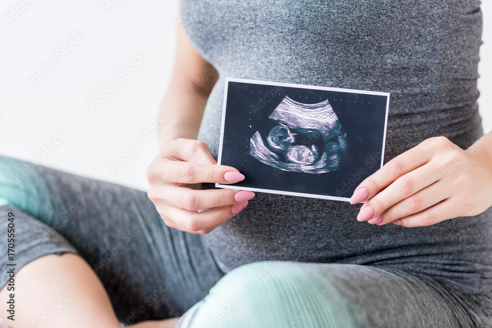 pregnant woman with ultrasound scan Stock Photo | Adobe Stock