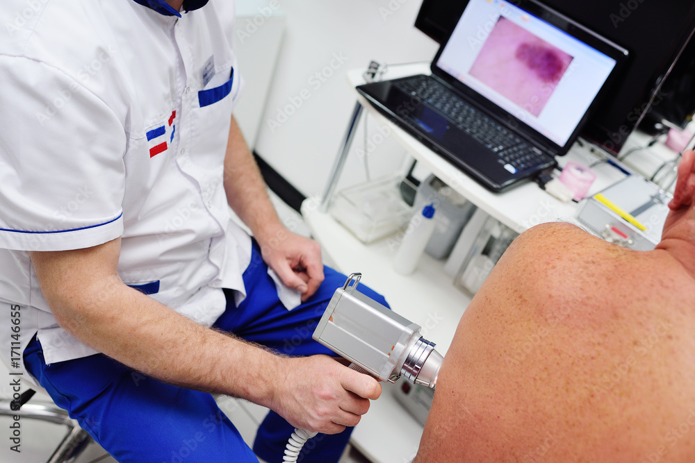 The dermatologist examines the moles or acne of the patient with a ...