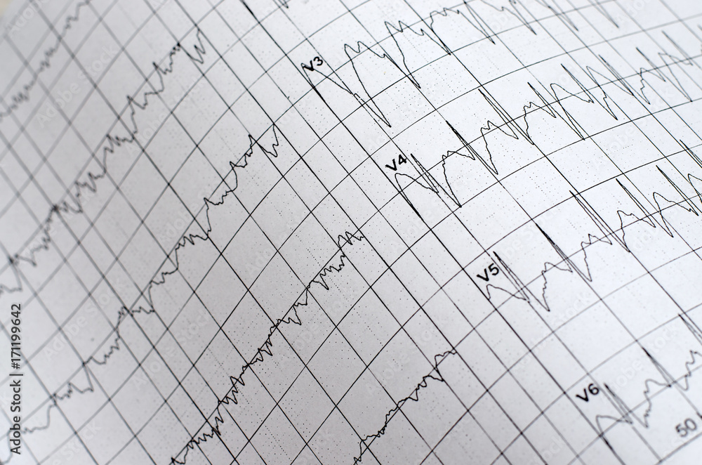 Electrocardiogram chart as medical background Stock Photo | Adobe Stock