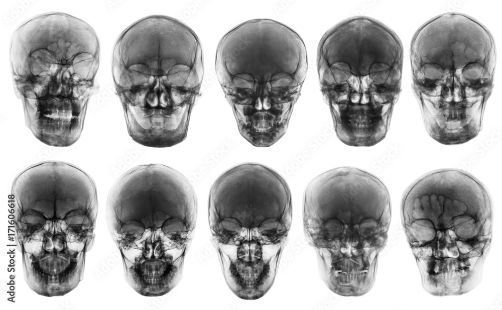 Collection of asian skull . front view . isolated background Stock ...