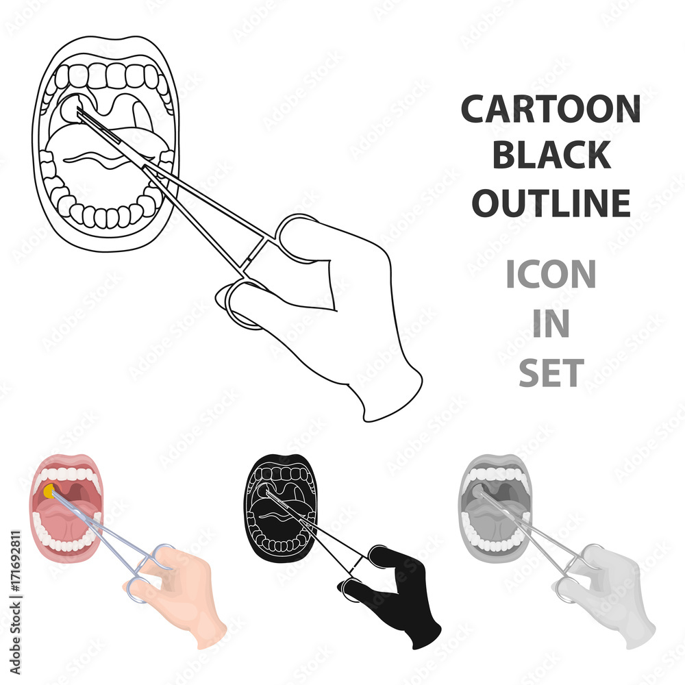 Treatment of the tonsils In the oral cavity. Medicine single icon in ...
