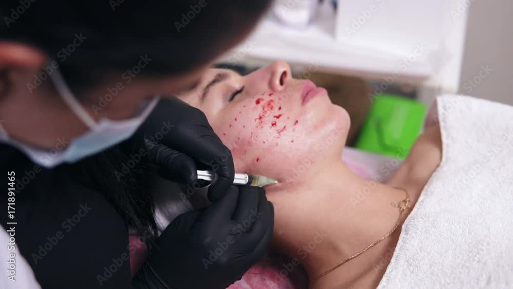 Anti-aging procedure: professional cosmetologist makes multiple ...