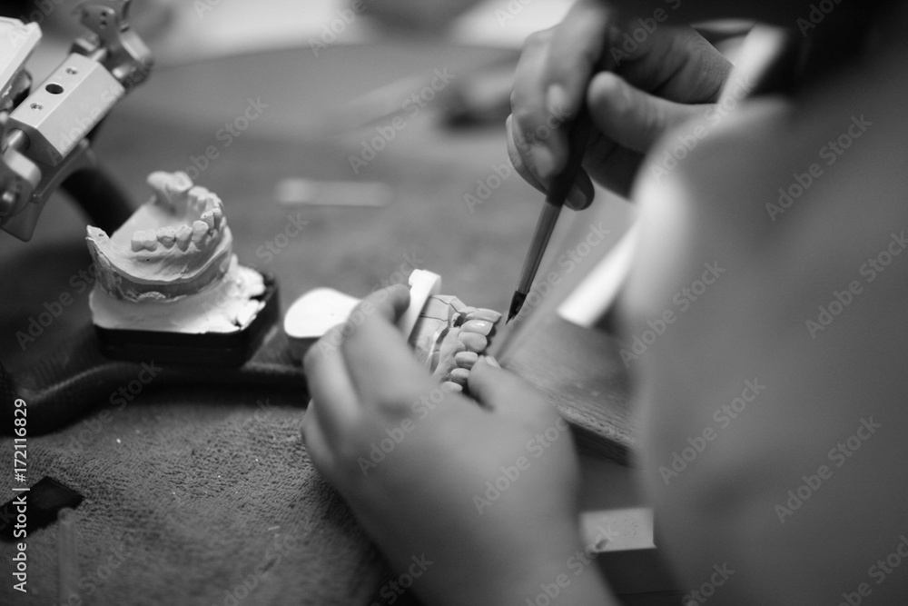 The process of manufacturing dentures in the dental laboratory Stock ...