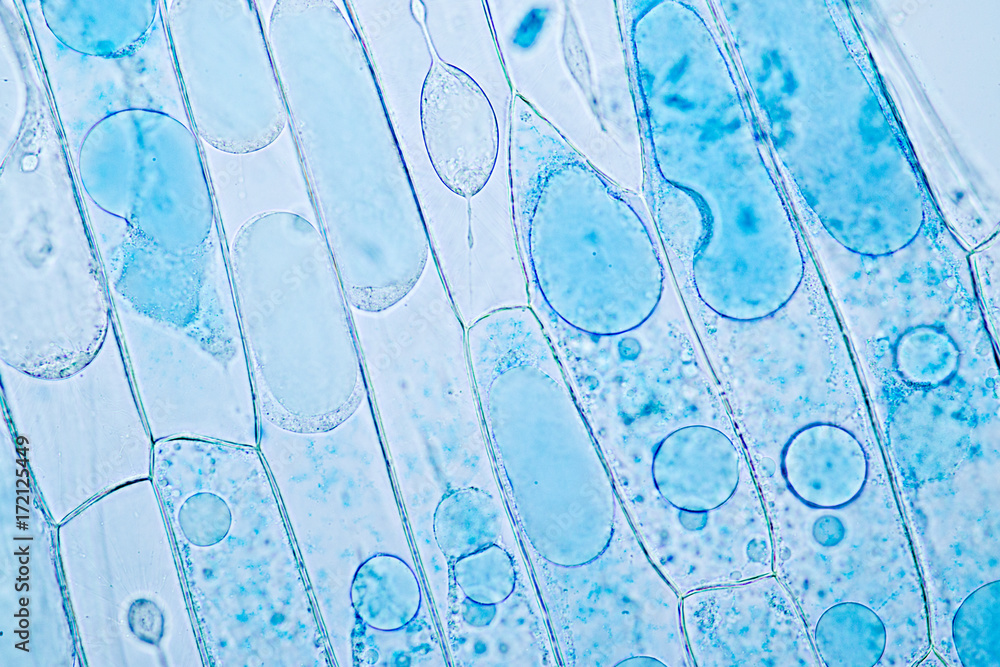 Cell structure plant (onion) showing under the microscope classroom ...