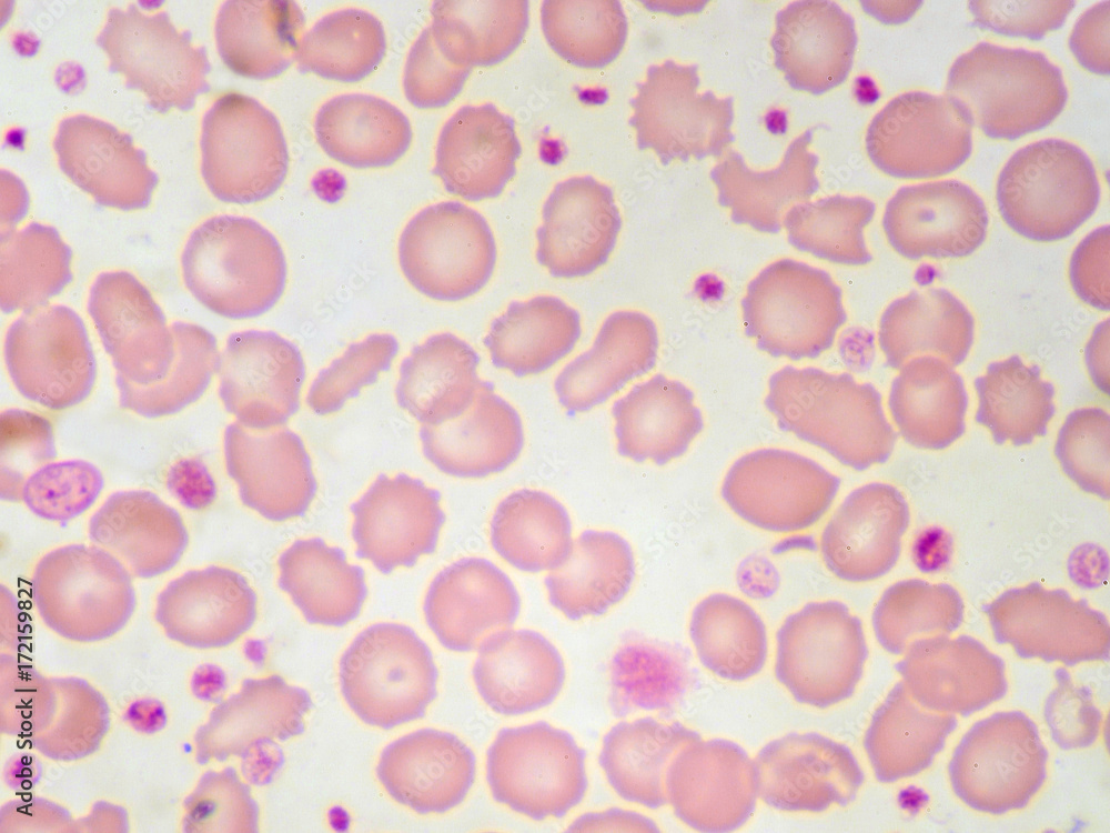 Red blood cells and platelet in blood smear Stock Photo | Adobe Stock