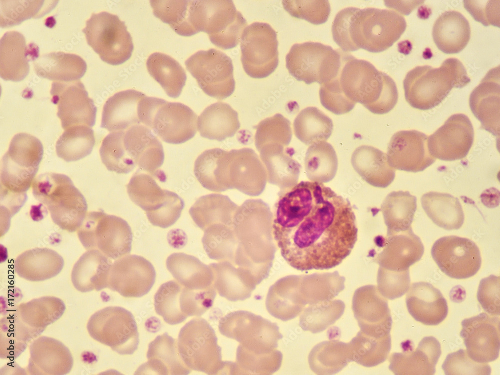 Eosinophil Under Microscope