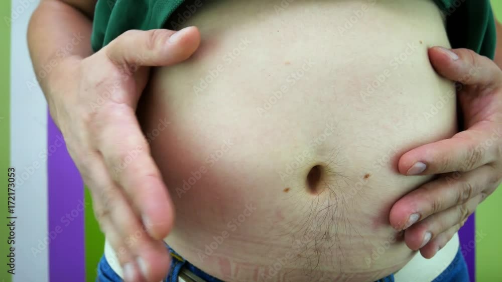 Little fat belly of overweight man. Stomach fat of young obesity male ...