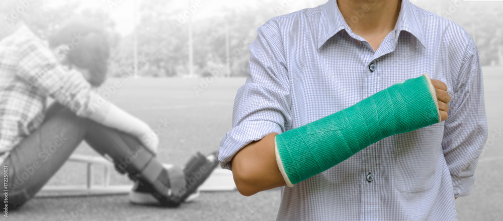 Green Arm Cast