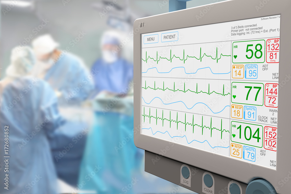 Intensive care unit (ICU) LCD monitor, light screen, with an ongoing ...