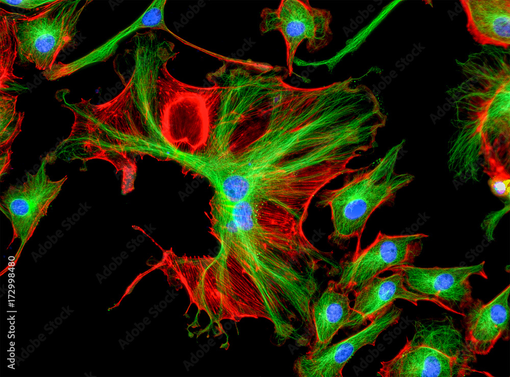 Fluorescence Microscope image of Bovine Pulmonary Artery Endothelial ...